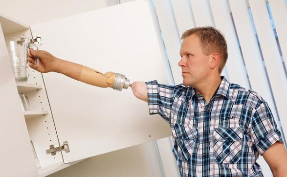 Prosthesis connects directly to bone, nerves and muscles